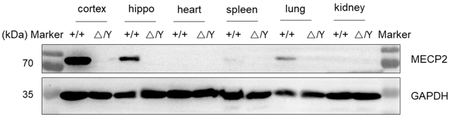 Unlocking the Autism Puzzle: Genes, Minds, and Untold Possibilities